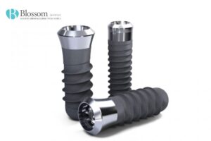 Loại Implant nào là tốt nhất hiện nay? - Nha Khoa Blossom