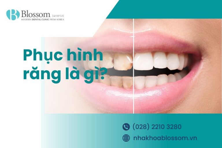 Phục hình răng là gì? Các phương pháp phục hình răng