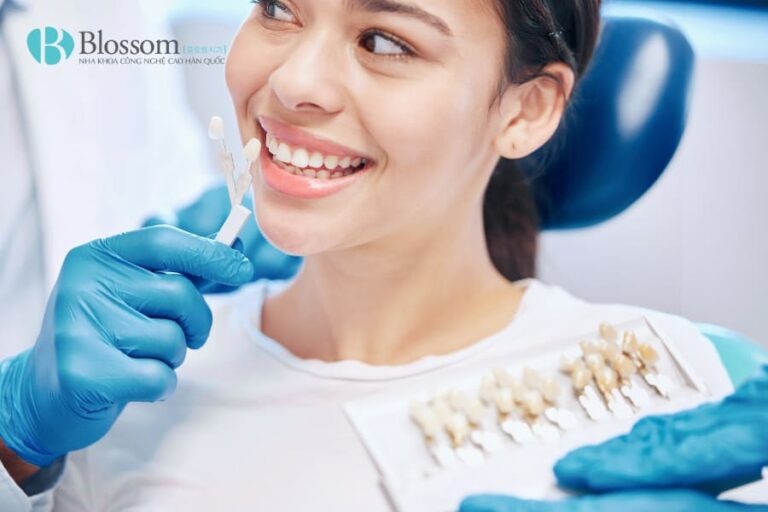 Dáng răng sứ đẹp – 10 mẫu được ưa chuộng và cách chọn chuẩn nhất